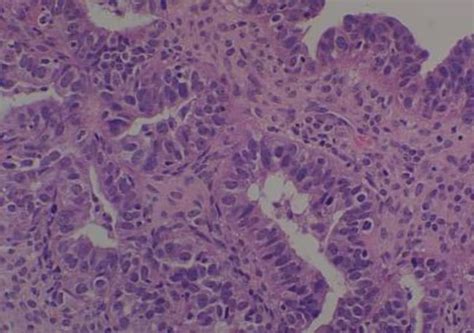 Novus Biologicals™ Human Ovary Tissue Microarray Cancer Slide Human