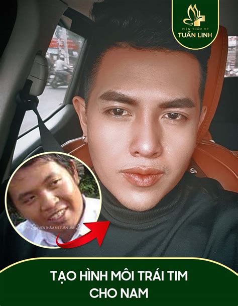 Qa C T M I Tr I Tim Cho Nam N Ng C N N L M P