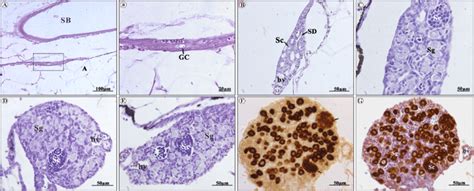 Testis Differentiation And Germ Cells Identification In S Prenanti