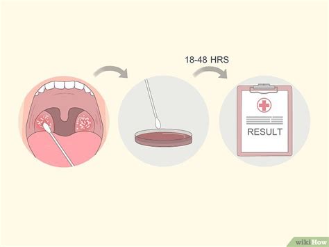 Come Capire Se Hai Uninfezione Da Streptococco Alla Gola