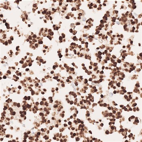 Cell Marque Mmr Analyte Control