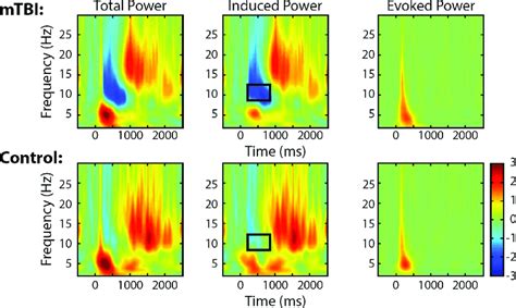 Shows A Comparison Mtbi Vs Controls Of Time Frequency Plots Of Mean