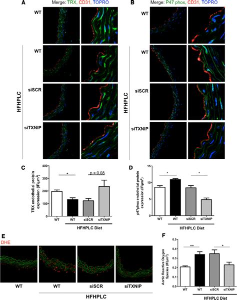 Targeting Endothelial Txnip Protects The Aorta From Oxidative Stress Download Scientific