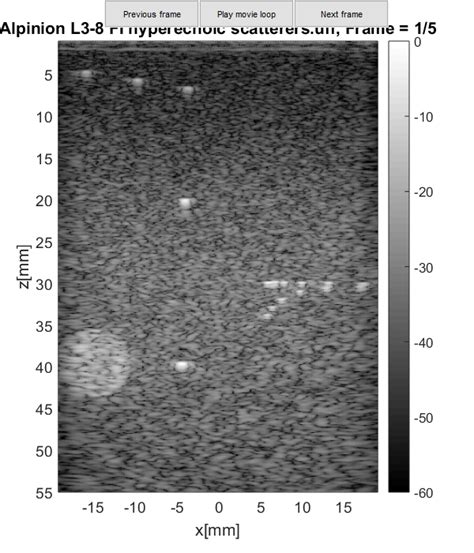 Reading Fi Data From An Uff File Recorded From An Alpinion Scanner