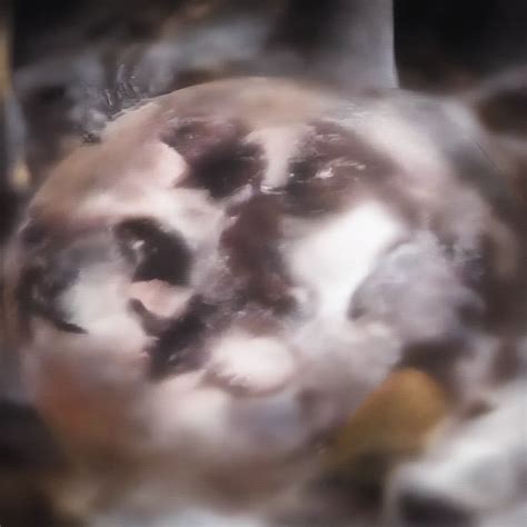 Sumatriptan Subcutaneous Injection An In Depth Analysis