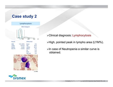 Histogram Interpretation For Result Analysis Pdf