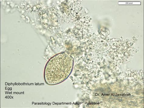 Diphyllobothrium Latum