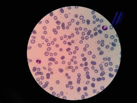 Gambar Sel Eritrosit 50 Koleksi Gambar