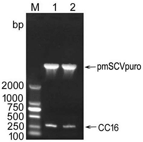 Recombinant Human Cc16 Gene Construction Of Eukaryotic Expression