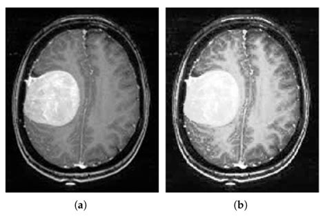 Linear Contrast Stretch Outcomes A Input Brain Mri B Final