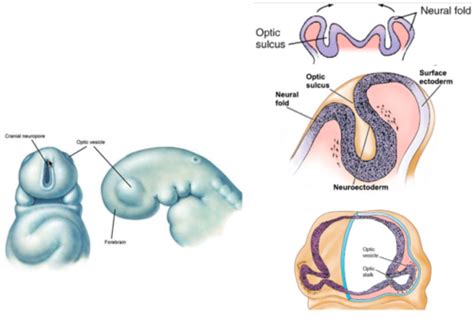 Eye Development Flashcards Quizlet