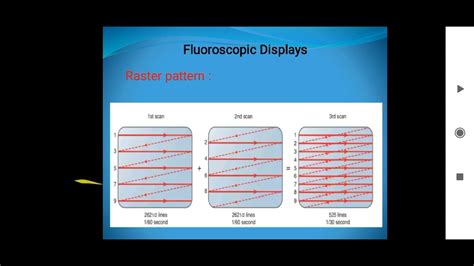 Understanding Fluoroscopy Components And Functionality Galaxy Ai
