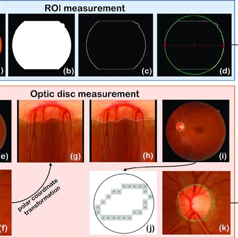 Automated Roi Measurement And Optic Disc Measurement A D Are The Download Scientific Diagram