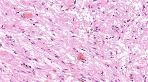 Week 1 Pqs Flashcards Quizlet