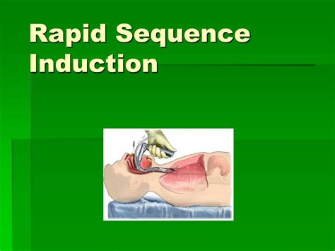 Ppt Rapid Sequence Induction Powerpoint Presentation Free Download Id 6695255