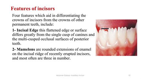 Morphology Of Maxillary Incisor Ppt