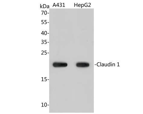 Claudin 1 Recombinant Rabbit Monoclonal Antibody Ps01 43 Ha721248