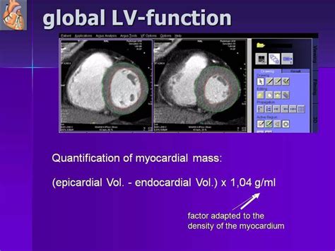 Advances In Ct Technology Pptx