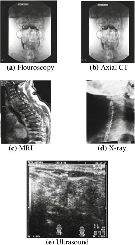 Figure 1 From Effect Of Frequency Domain Filters On Bio Medical Images
