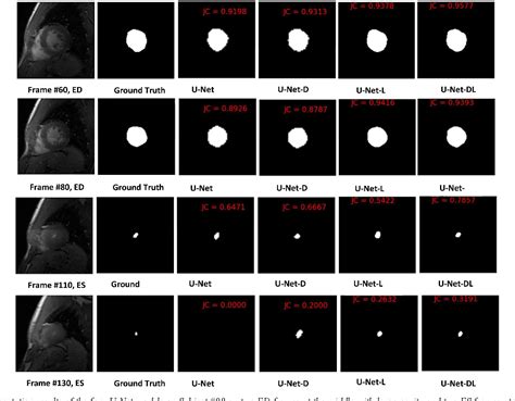 Figure 3 From Deep Convolutional Neural Networks For Automatic Segmentation Of Left Ventricle