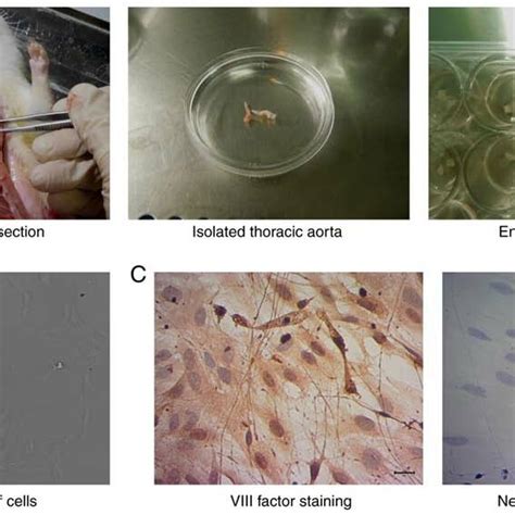 Illustration Of The Process For Thoracic Aorta Isolation And Primary Download Scientific
