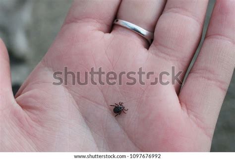 Oak Mite Bites Photos Images And Pictures Shutterstock