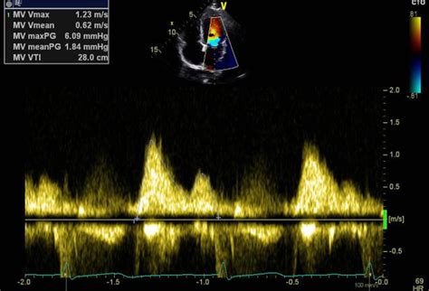 GC CVT Echo Visual Protocol