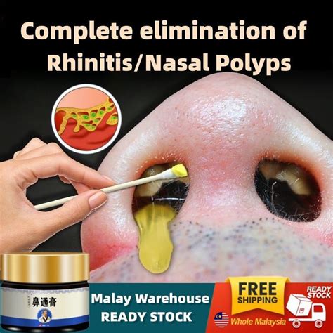 Nasal Congestion Ointment Nasal Passage Ointment 20g Sinus Care
