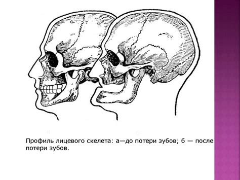 Ортопедическое лечение при полном отсутствии зубов презентация онлайн