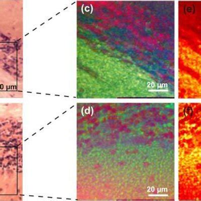 Comparison Of Images Taken By Traditional Bright Field Contrast Of HE Download Scientific