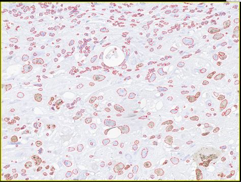 Different Results Between QuPath Cellpose Extension And Cellpose GUI