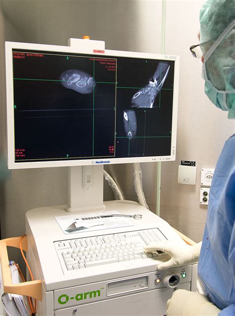 Display Of Multiplanar Reconstruction Images Download Scientific Diagram