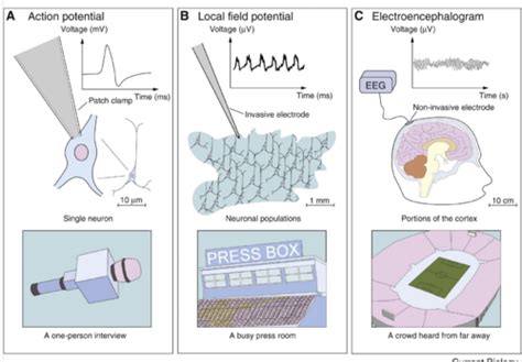 Electroencephalography Eeg Flashcards Quizlet