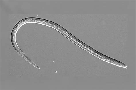 피부 뚫고 감염되는 기생충…인체 안에서 어떻게 길 찾을까 [와우 과학]