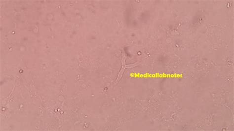 Aspergillus Fumigatus Introduction Morphology Pathogenicity Lab