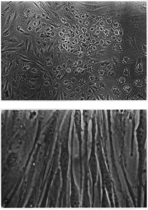Phase Contrast Photomicrograph Of Cultured Glomerular Epithelial Cells