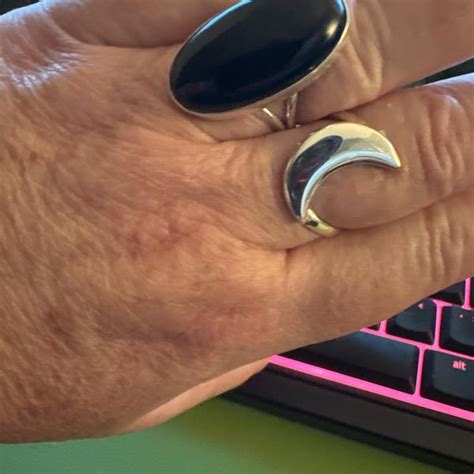 Mcpdeviation Splint Ring • Mcp Deviation Splint Ring • Silver Splint