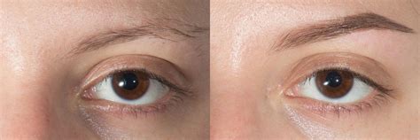 Negative Canthal Tilt The Ultimate Guide Meaning Fix Vs Positive