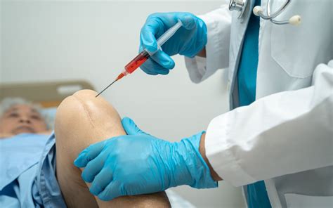 Intra Articular Injections Prp Injections And Prolotherapy Dr Arun Dev