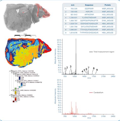 Figure 1 From High Speed Maldi Toftof Imaging Of Mouse Brain Tissue