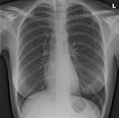 Test Yourself Regular Sets Set 14 Emergency Department Radiology Courses