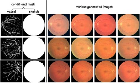 The Visualization Of Conditional Generation Results On Drive Dataset