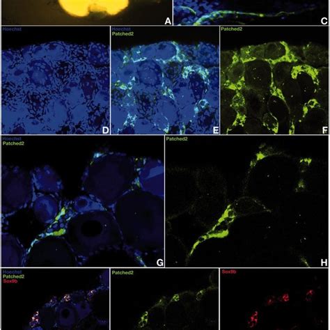 Spatial And Temporal Expression Patterns Of Patched 2 During Medaka