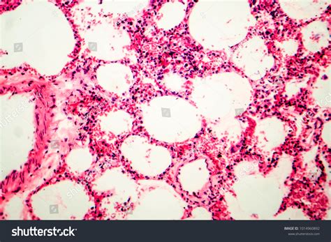Lung Histology Alveoli