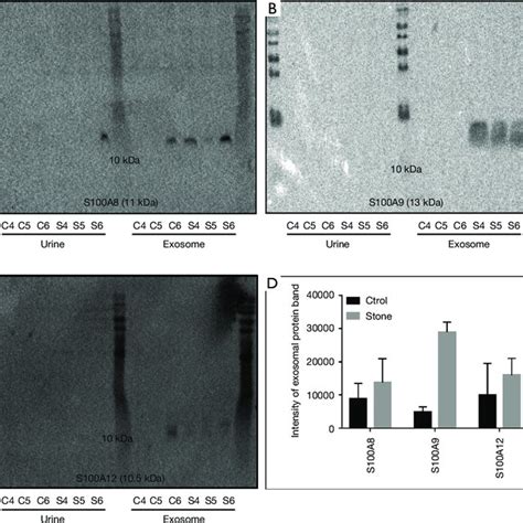 Proteomic Profiling Of Human Urinary Exosomes A A Total Of 960