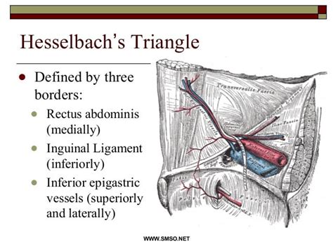 Hernia 1