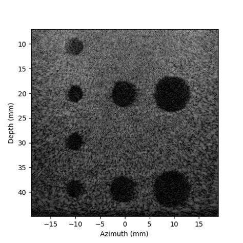 Developing End To End Real Time Applications With The Nvidia Clara Agx Developer Kit Nvidia