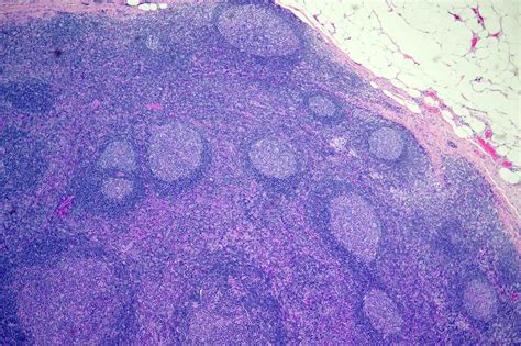 Lymph Node Follicle Histology The Histology Of Low Grade B Cell