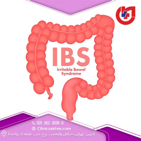 علائم سندروم روده تحریک‌پذیر چیست؟