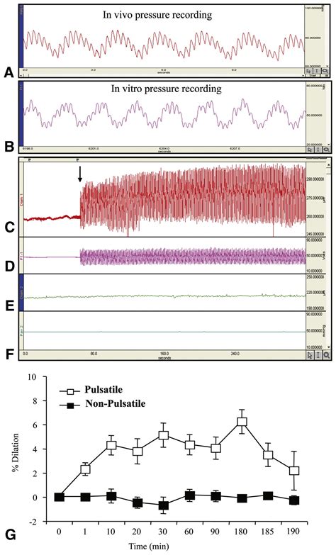 In Vitro Protection Of Vascular Function From Oxidative Stress And